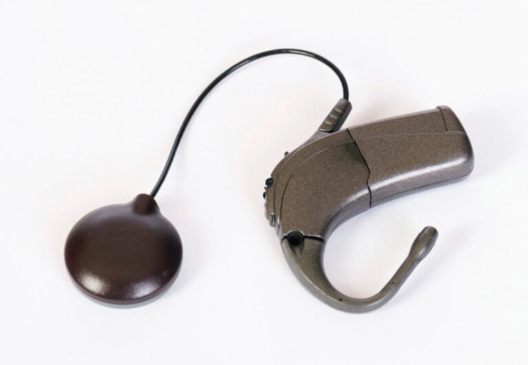 Cochlear Implants - UCI Audiology